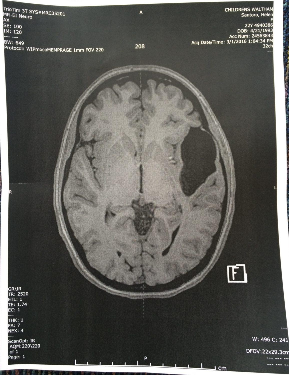 Her plastic brain - BrainWise Media